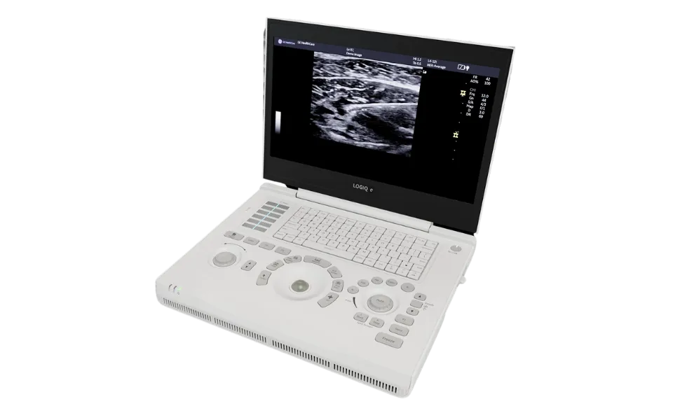 Logiq e | Ecógrafo portátil | Intec | General Electric HealthCare Argentina